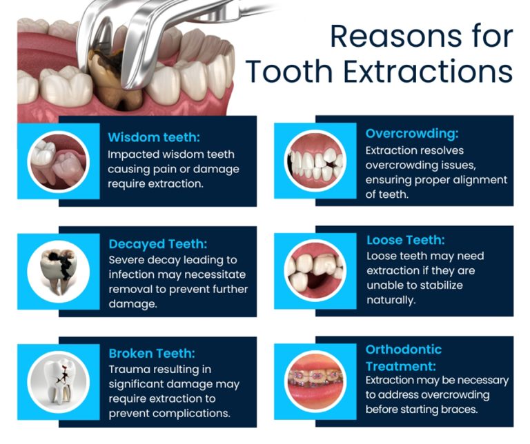 Is a Tooth Extraction Painful? | Broadway Family and Cosmetic Dentistry
